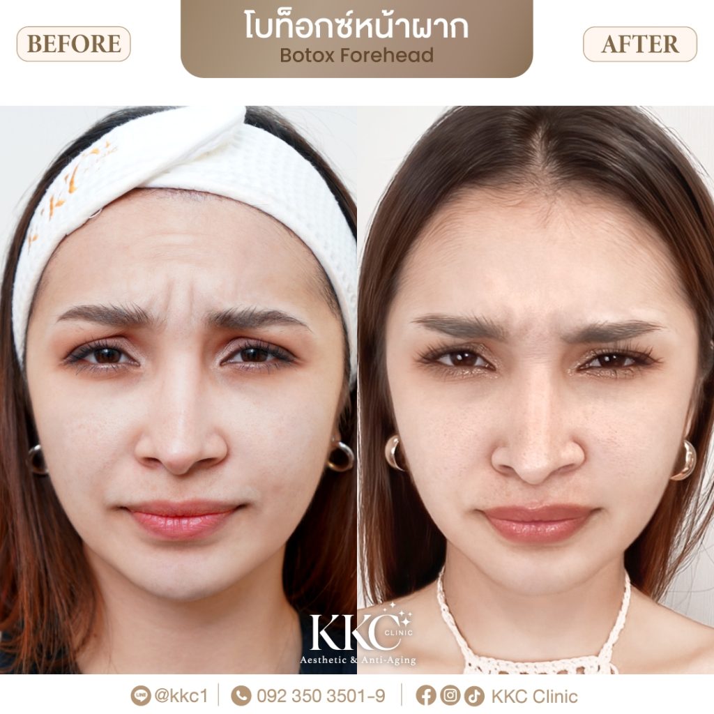 Before & After | KKC Clinic