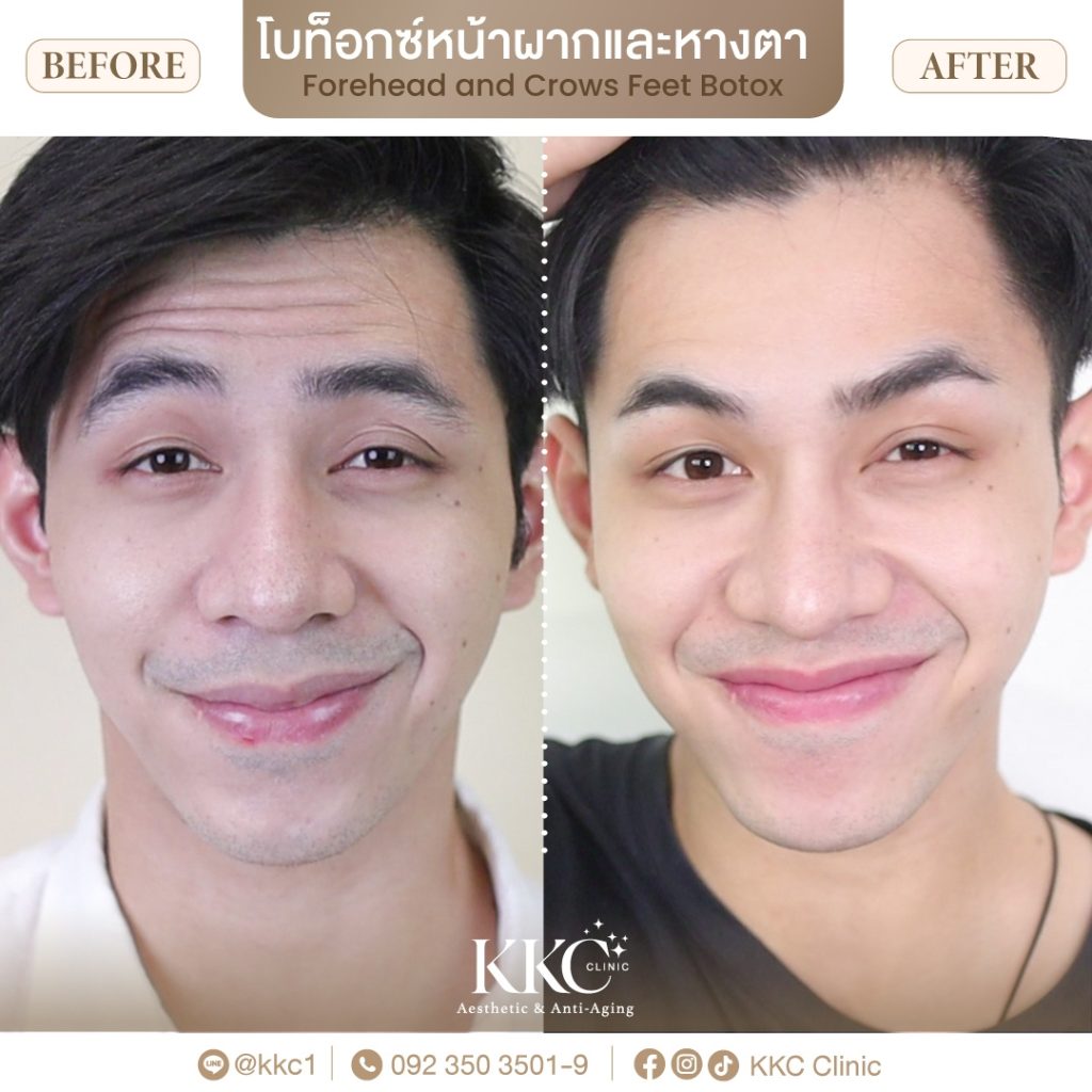 Before & After | KKC Clinic