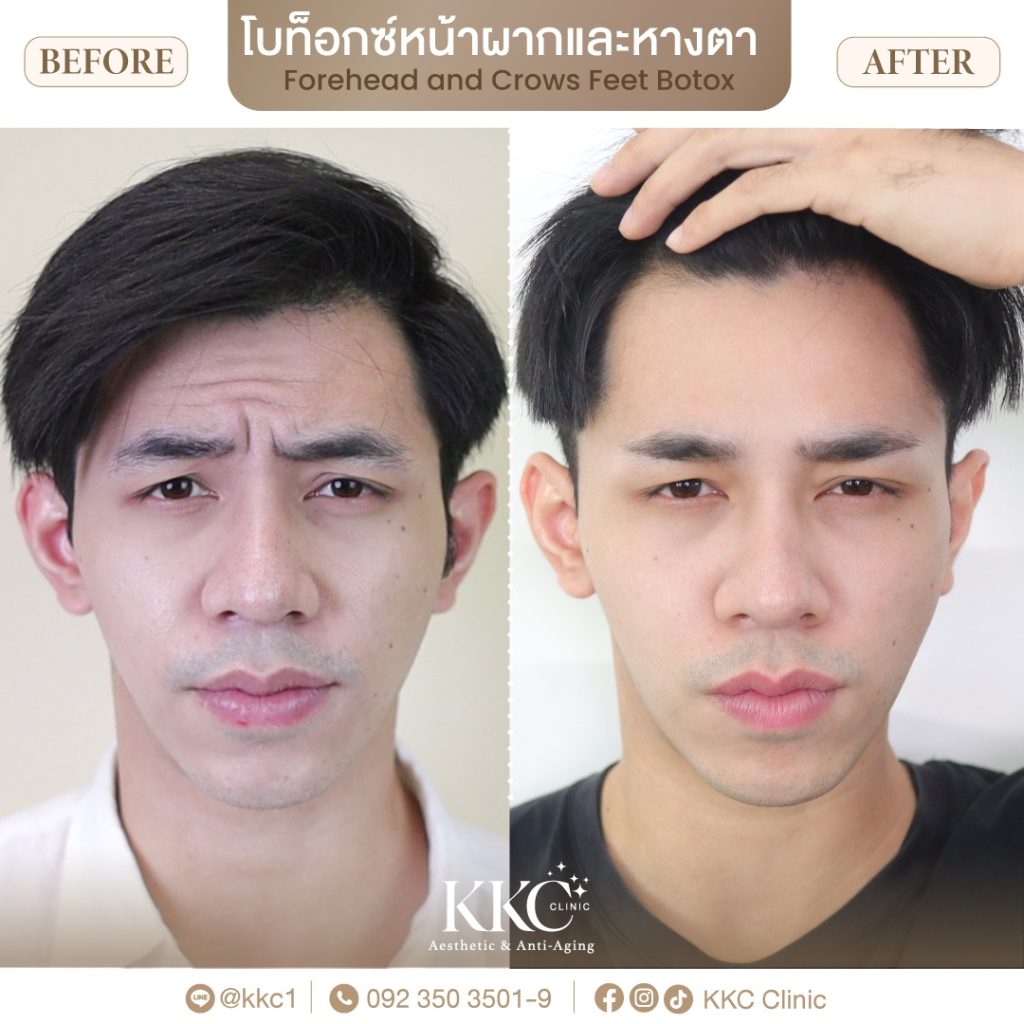 Before & After | KKC Clinic