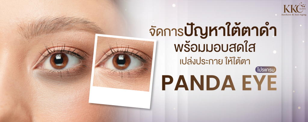 แก้ขอบตาดำ ด้วยการรักษา Panda Eye | KKC Clinic