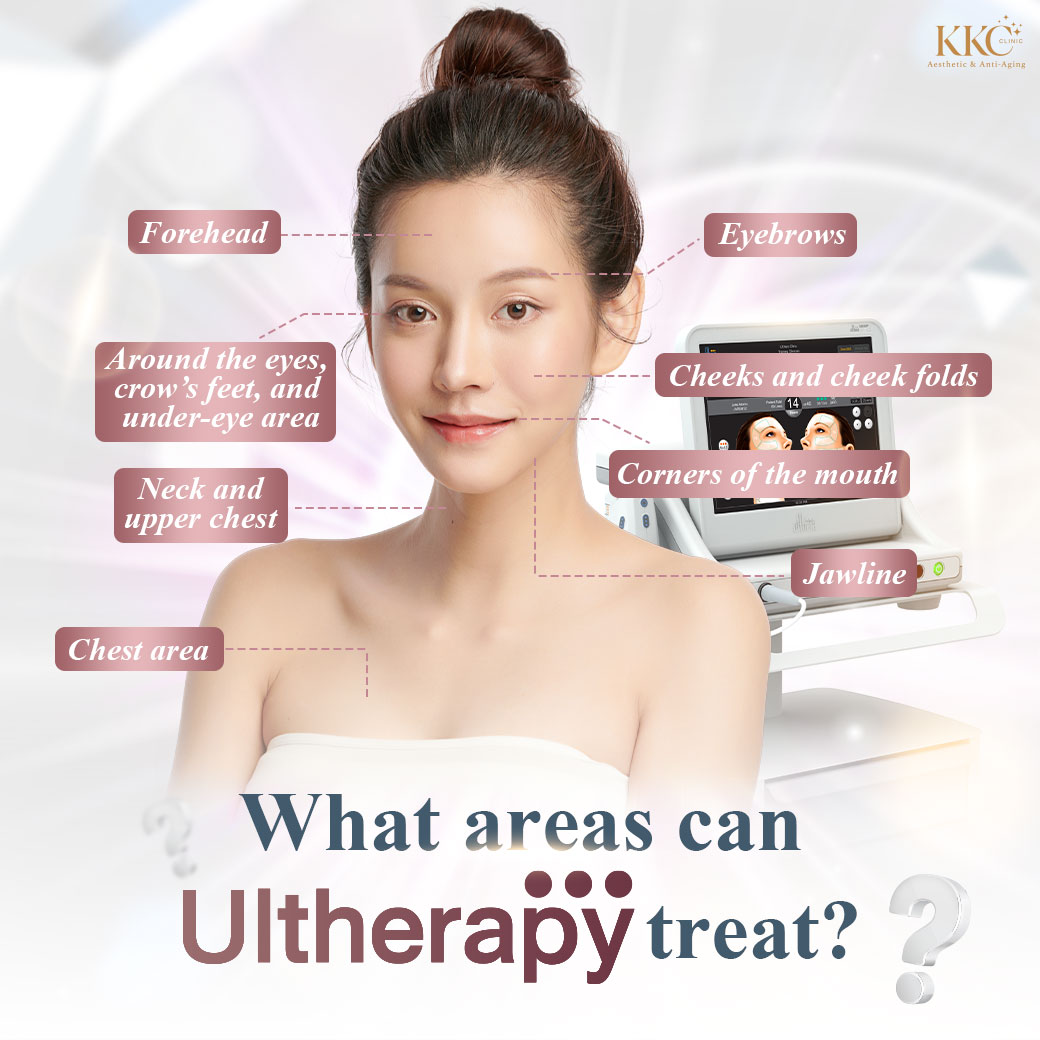 Ultherapy in Bangkok: A Non-surgical Facelift Alternative