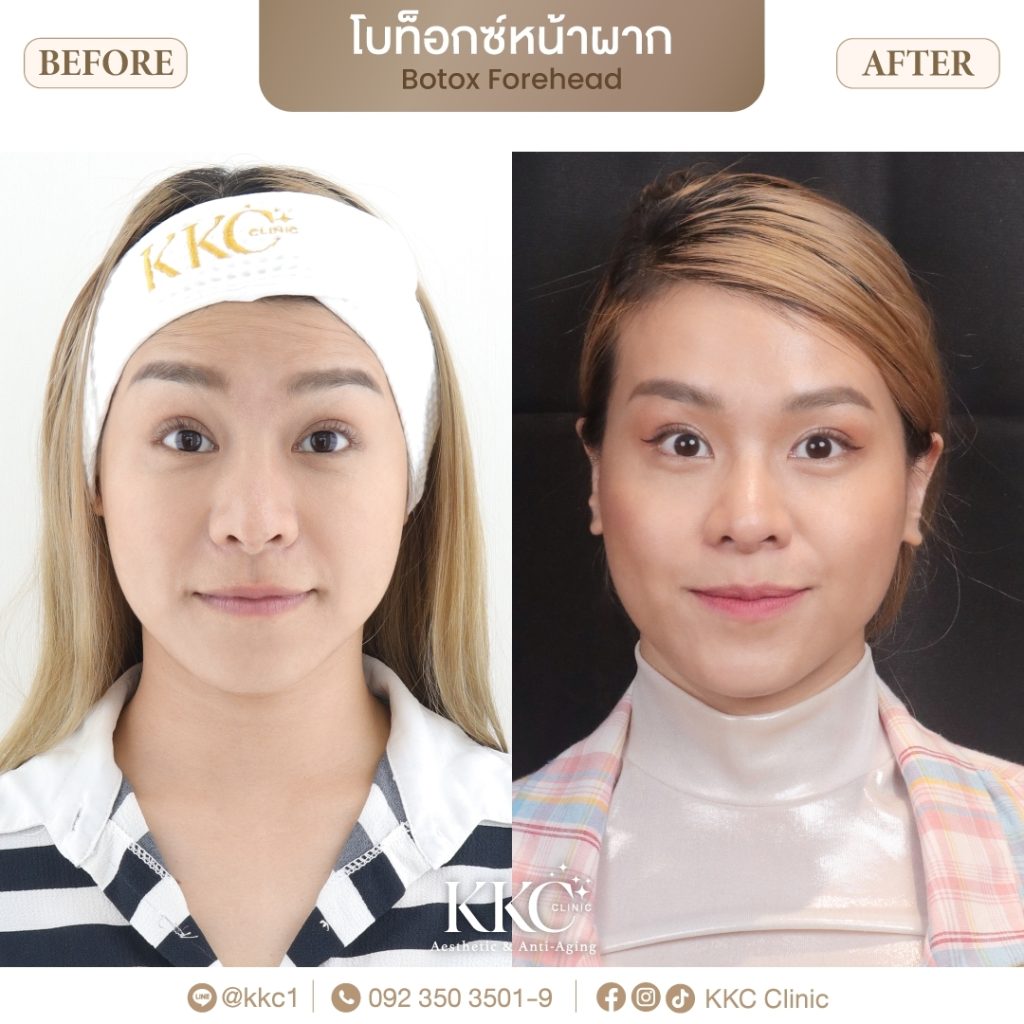 Before & After | KKC Clinic