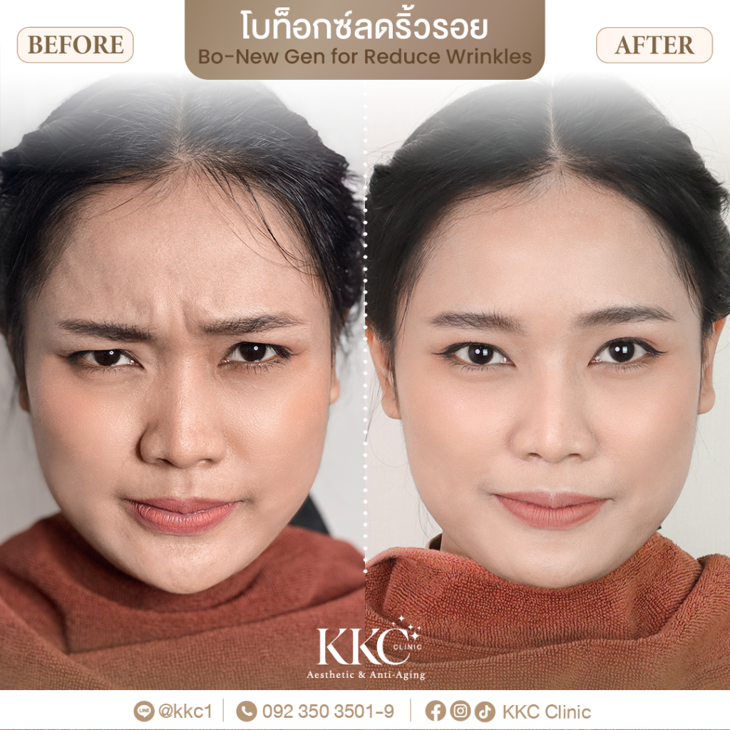 Before & After | KKC Clinic