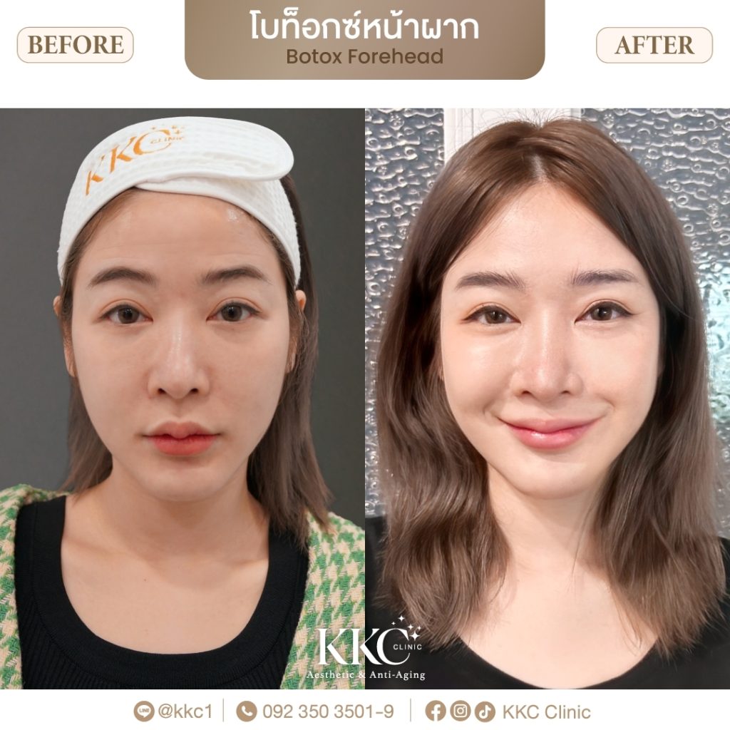 Before & After | KKC Clinic
