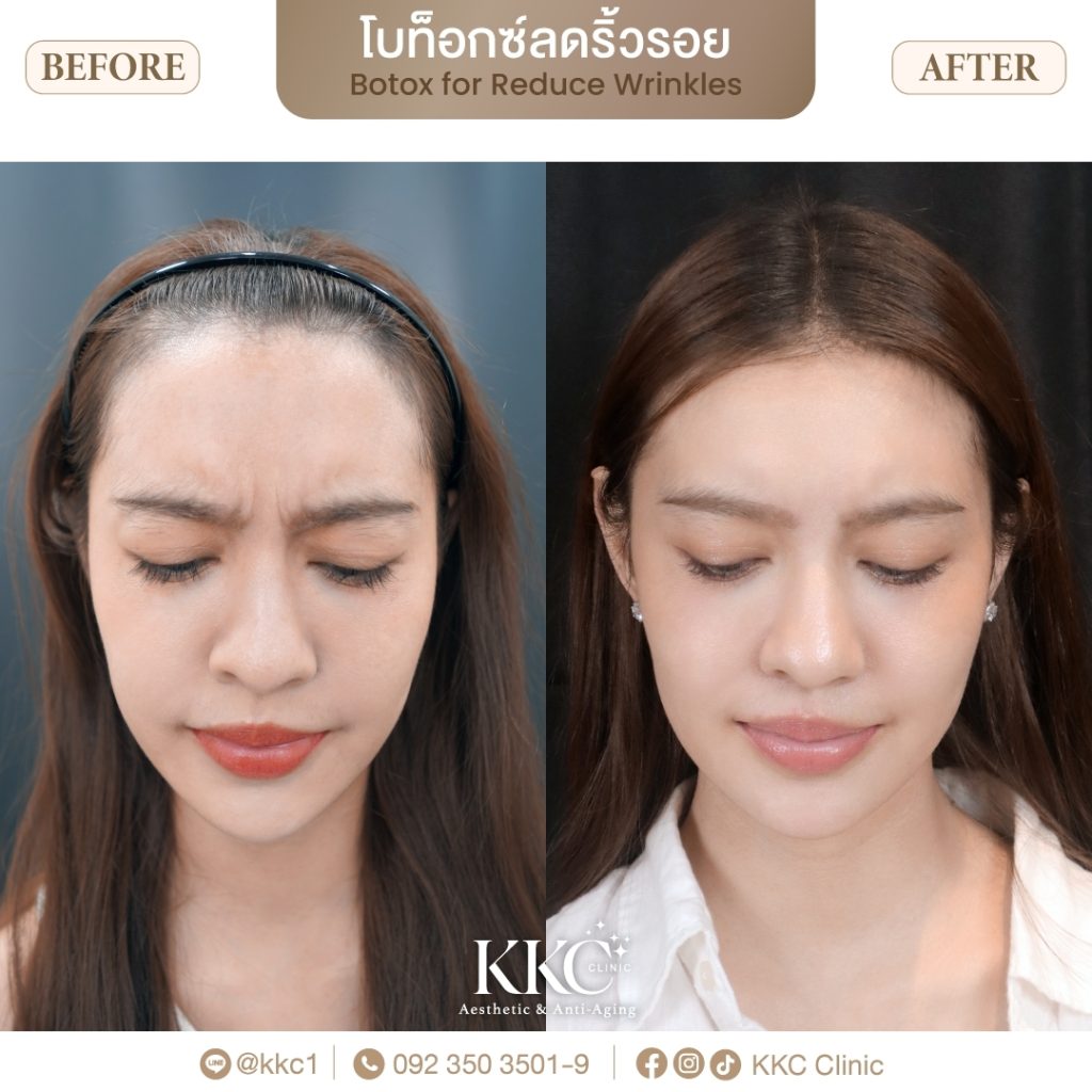 Before & After | KKC Clinic