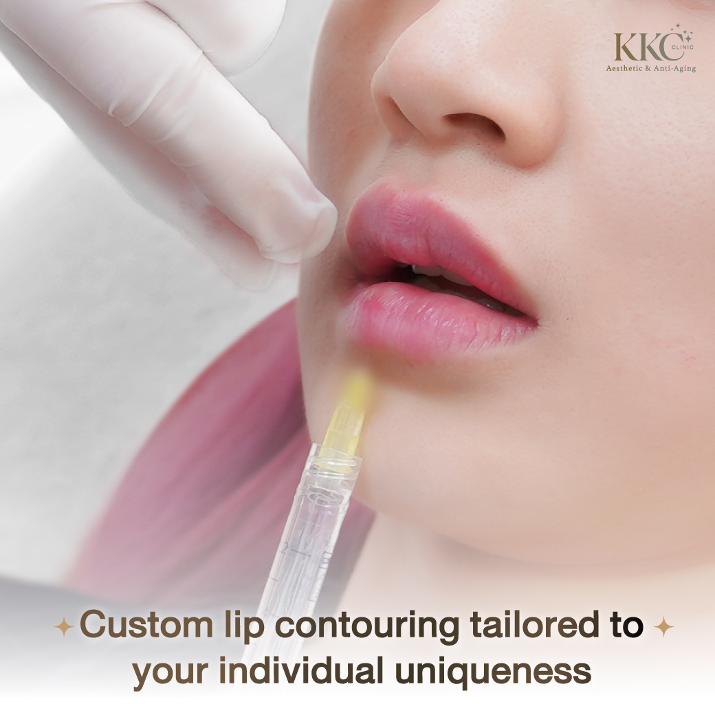 Lip Filler in Bangkok: Add Volume & Enhance Shape