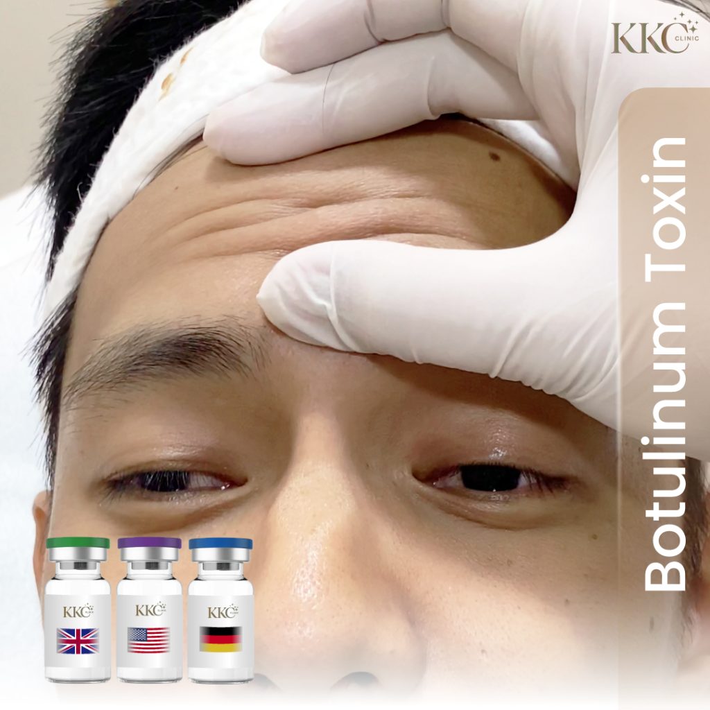 Best Botox Brands Compared: Allergan, Dysport, Xeomin | KKC Clinic