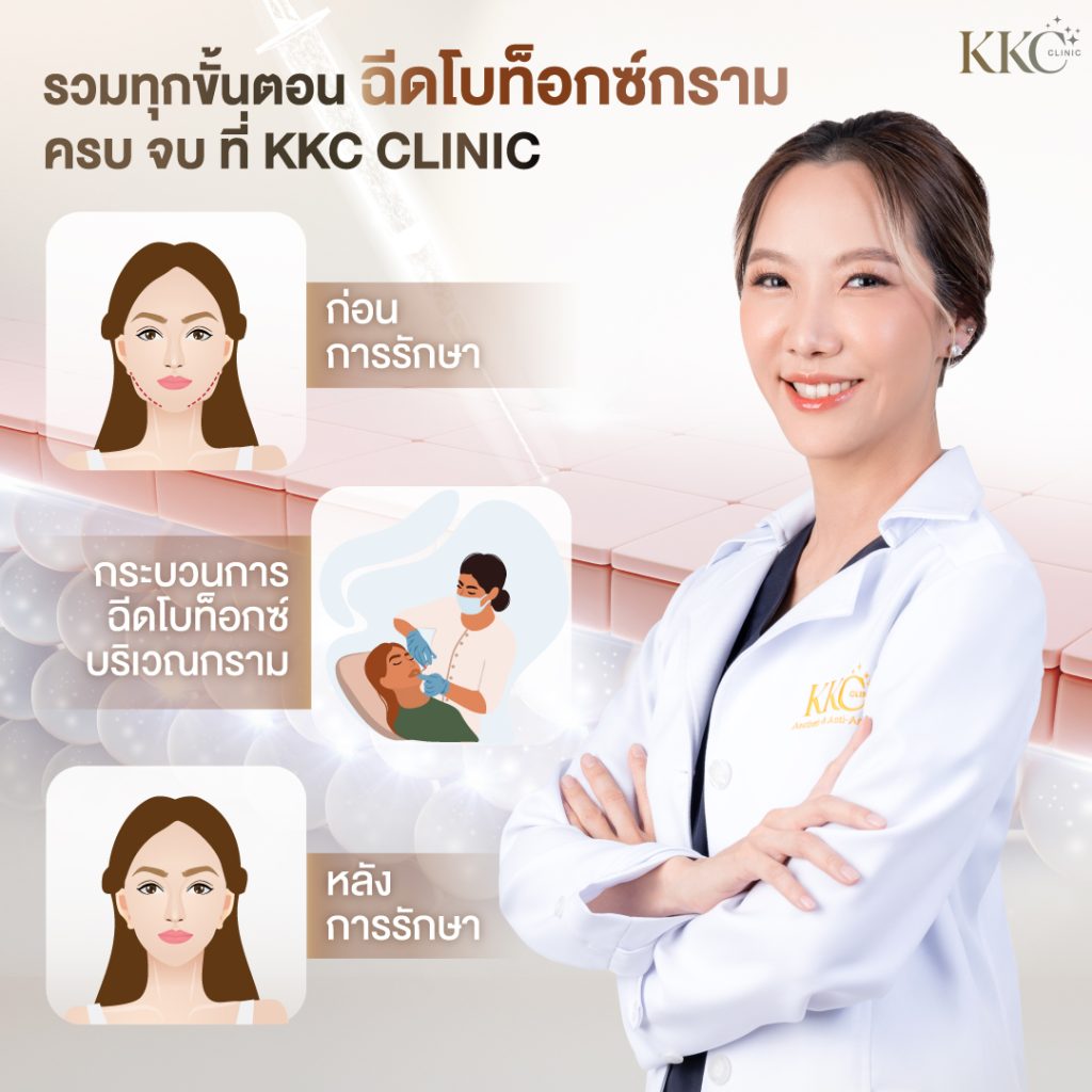 โบท็อกกรามหน้าเรียวด้วยเทคนิคพิเศษ ผลลัพธ์ชัดเจนที่ KKC Clinic