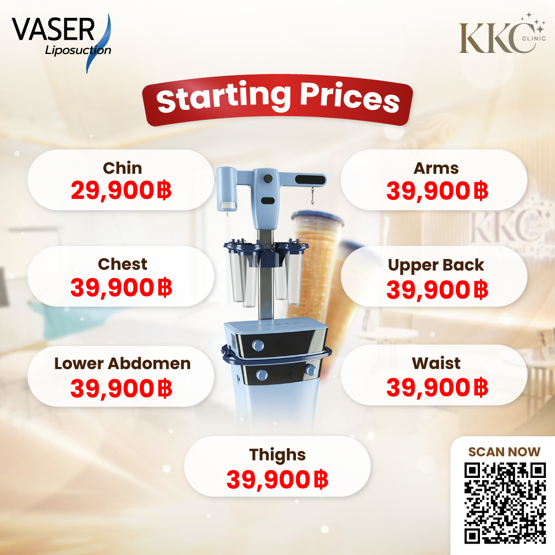 VASER Liposuction in Bangkok at KKC Clinic