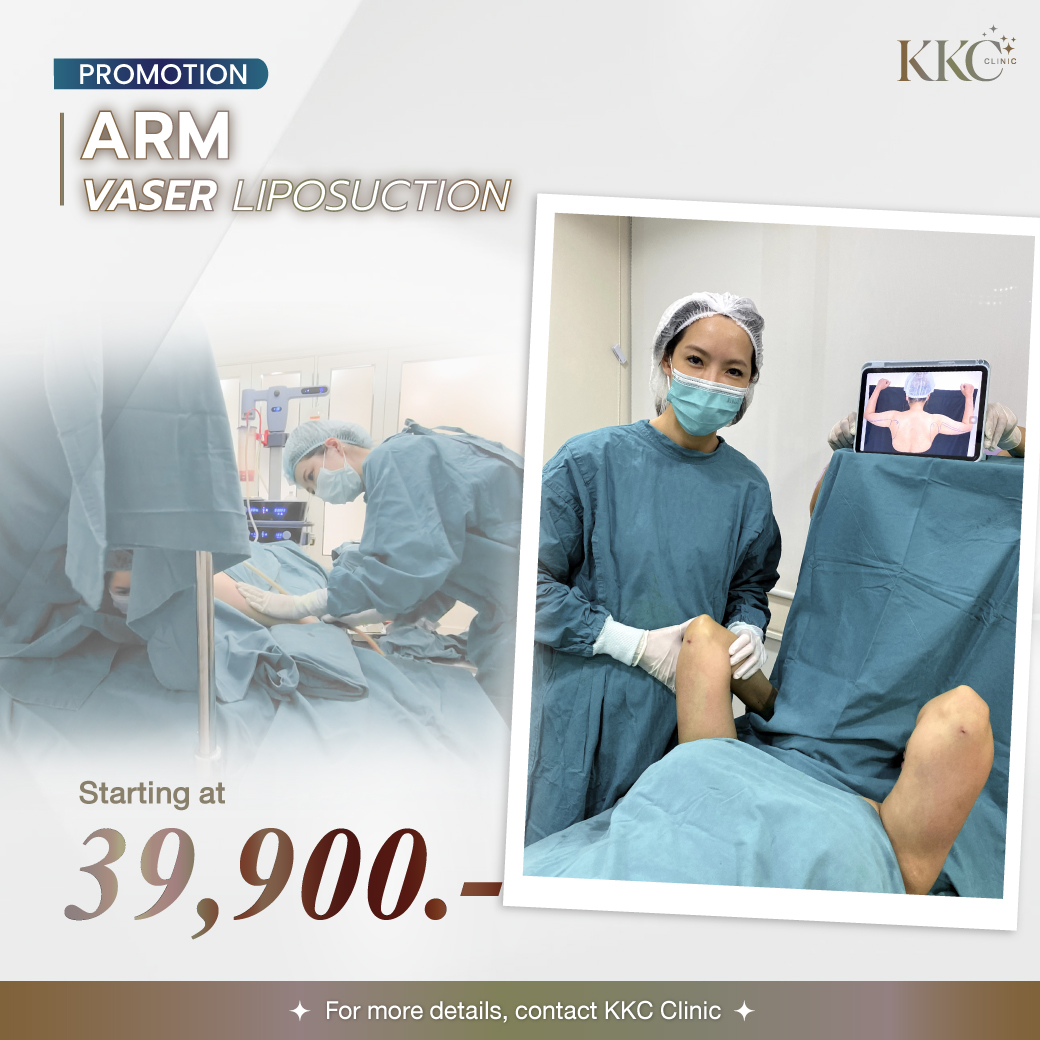 Arm Liposuction in Bangkok: Sculpt & Tone Your Arms | KKC Clinic