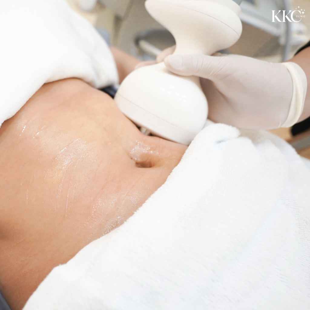 Cellulite Treatment in Bangkok with Venus Legacy