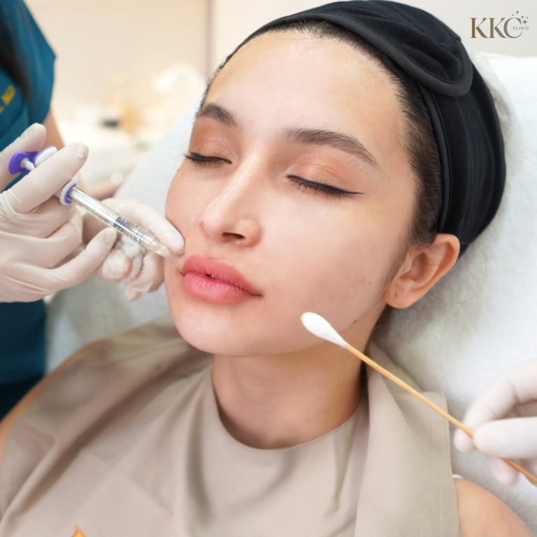 Lip Filler in Bangkok: Add Volume & Enhance Shape