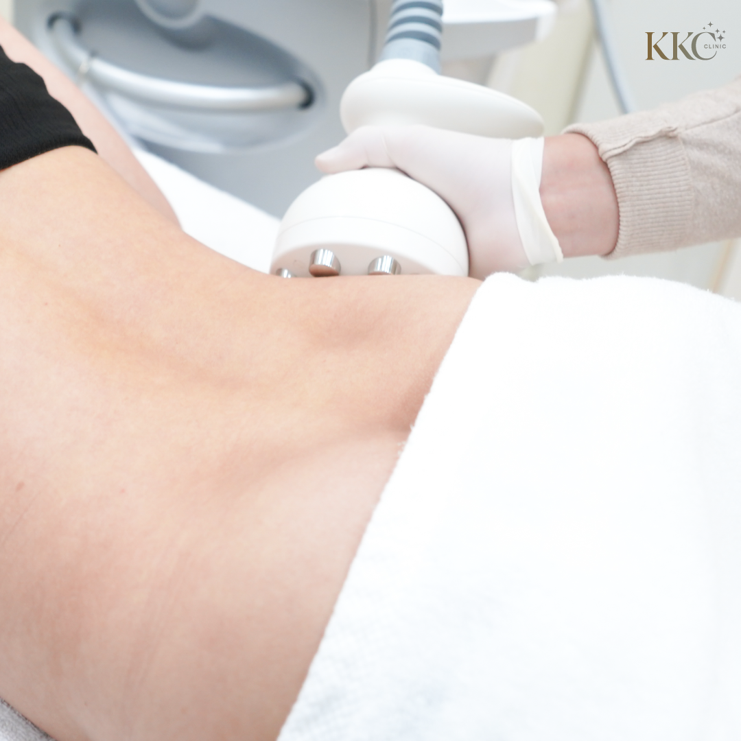 Cellulite Treatment in Bangkok with Venus Legacy