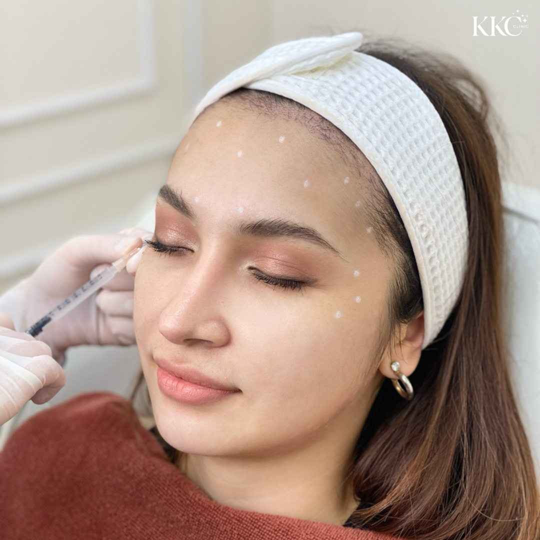 Botox in Bangkok | Prices, Treatment Areas & What to Expect